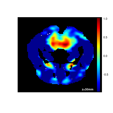 Real data analysis II: analyzing neuroimaging data using R - STAT 818 ...