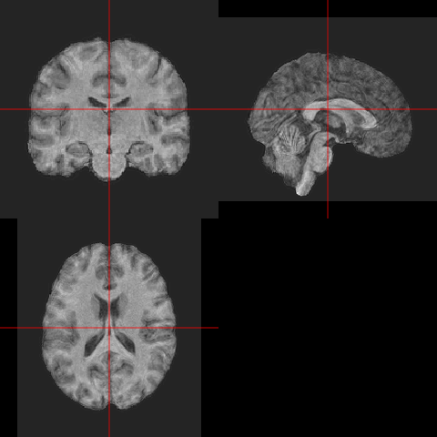 Analyzing neuroimaging data using ML/DL methods in R - LYQG blog